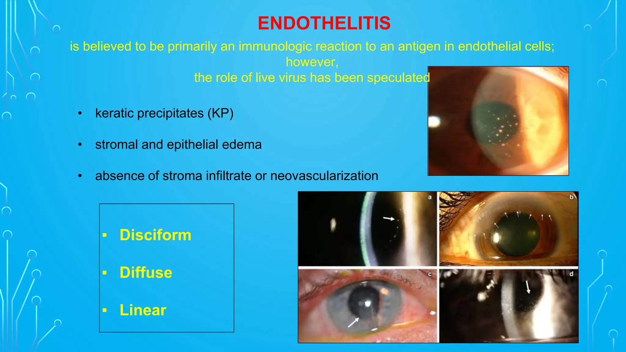Herpes Simplex Keratitis .pptx | Eye and Vision Conditions | Diseases ...