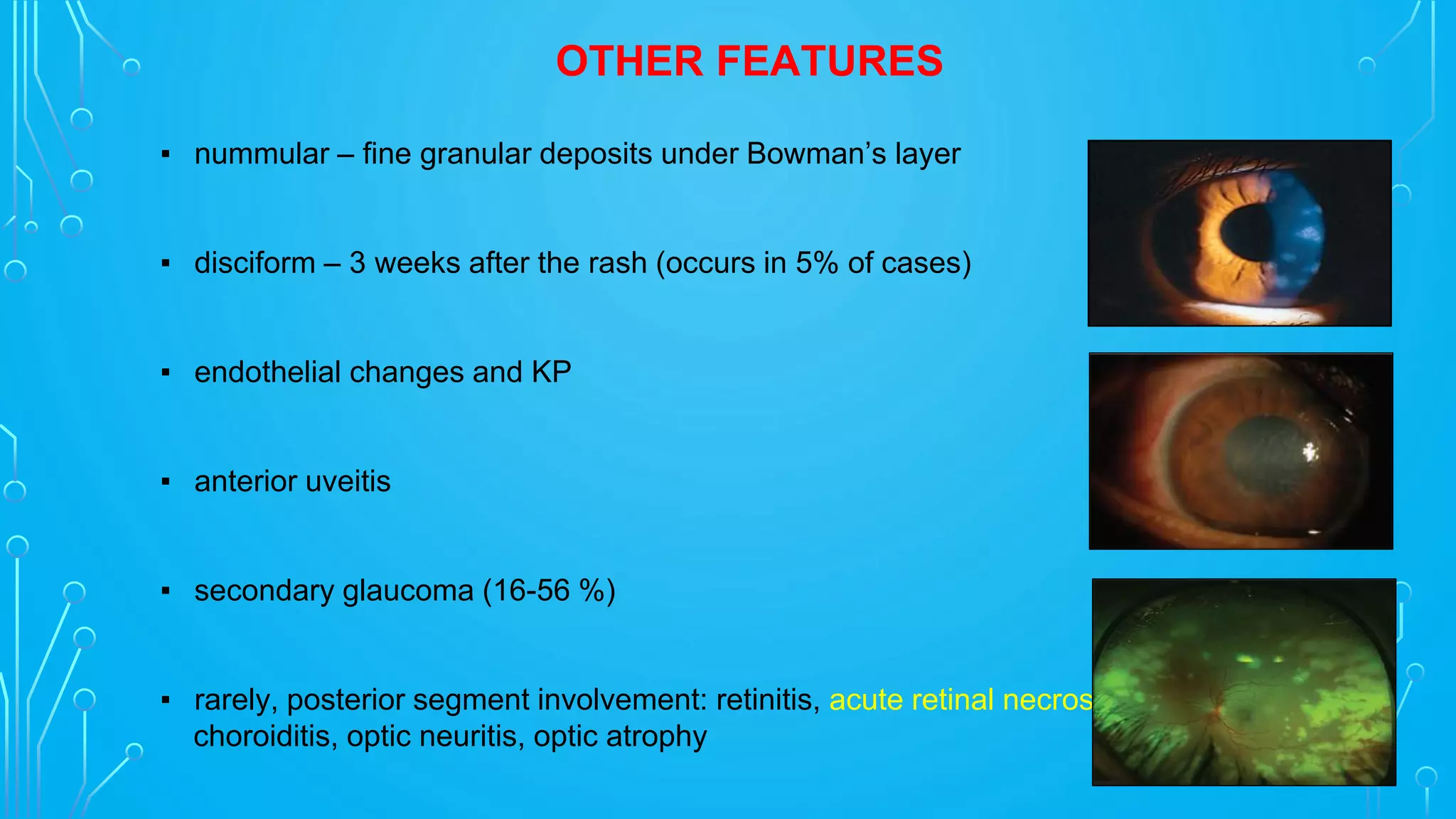 Herpes Simplex Keratitis .pptx | Eye and Vision Conditions | Diseases ...