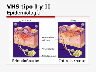 Herpes simplex perinatal | PPT