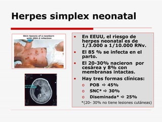 Herpes simplex perinatal | PPT