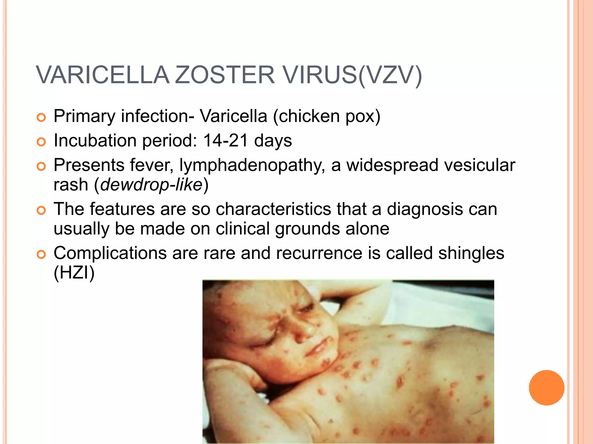 Herpes simplex virus, classification, clinical findings, oral ...