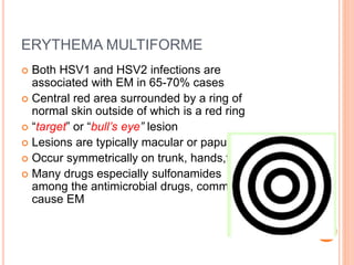 Herpes simplex virus, classification, clinical findings, oral ...