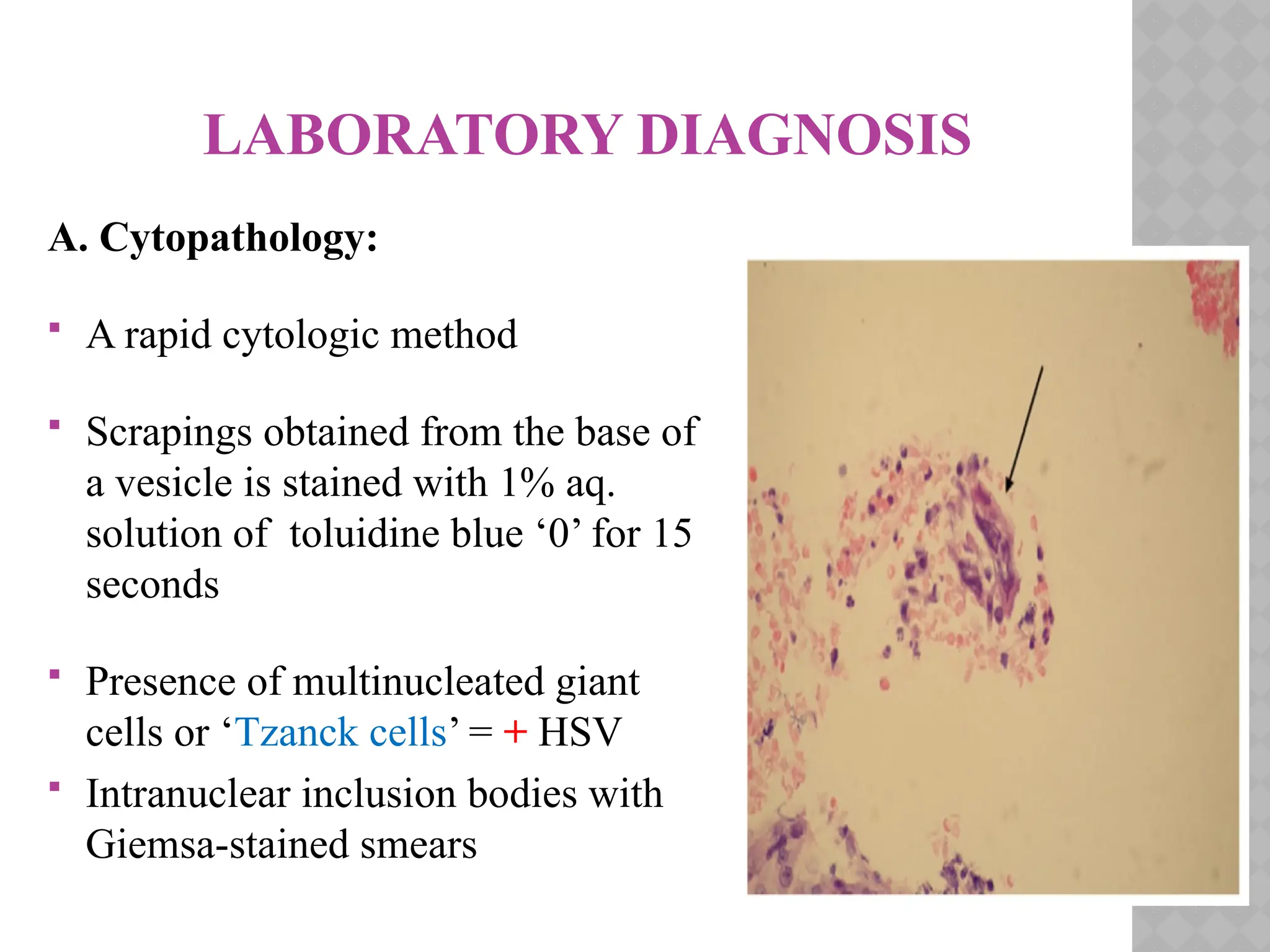 herpessimplexvirus-150808075848-lva1-app6891.pptx