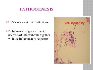 herpessimplexvirus-150808075848-lva1-app6891.pptx | Infectious Diseases ...