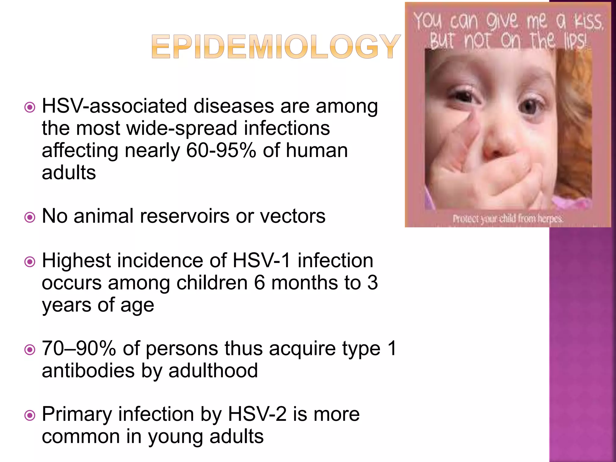 Herpes Simplex Virus Ppt