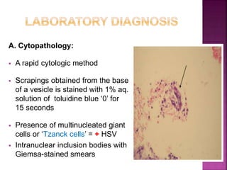Herpes simplex virus | PPTX