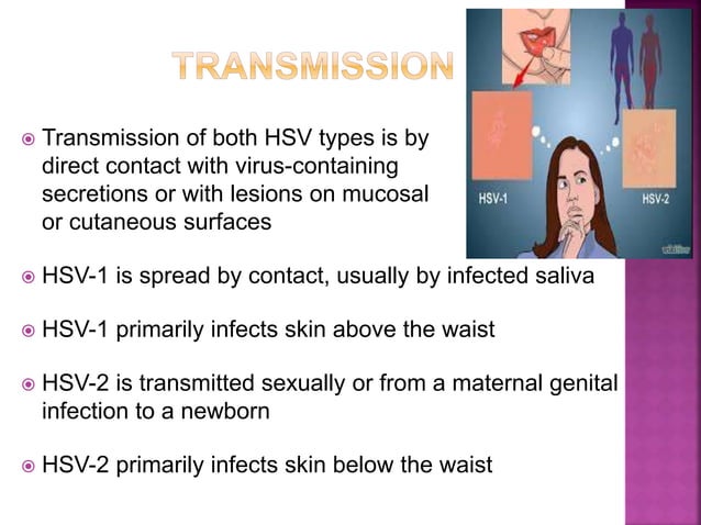 Herpes simplex virus | PPTX