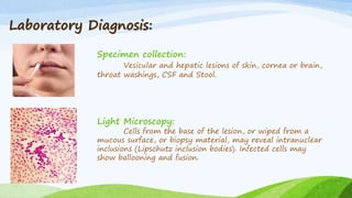 Herpes simplex virus | PPTX