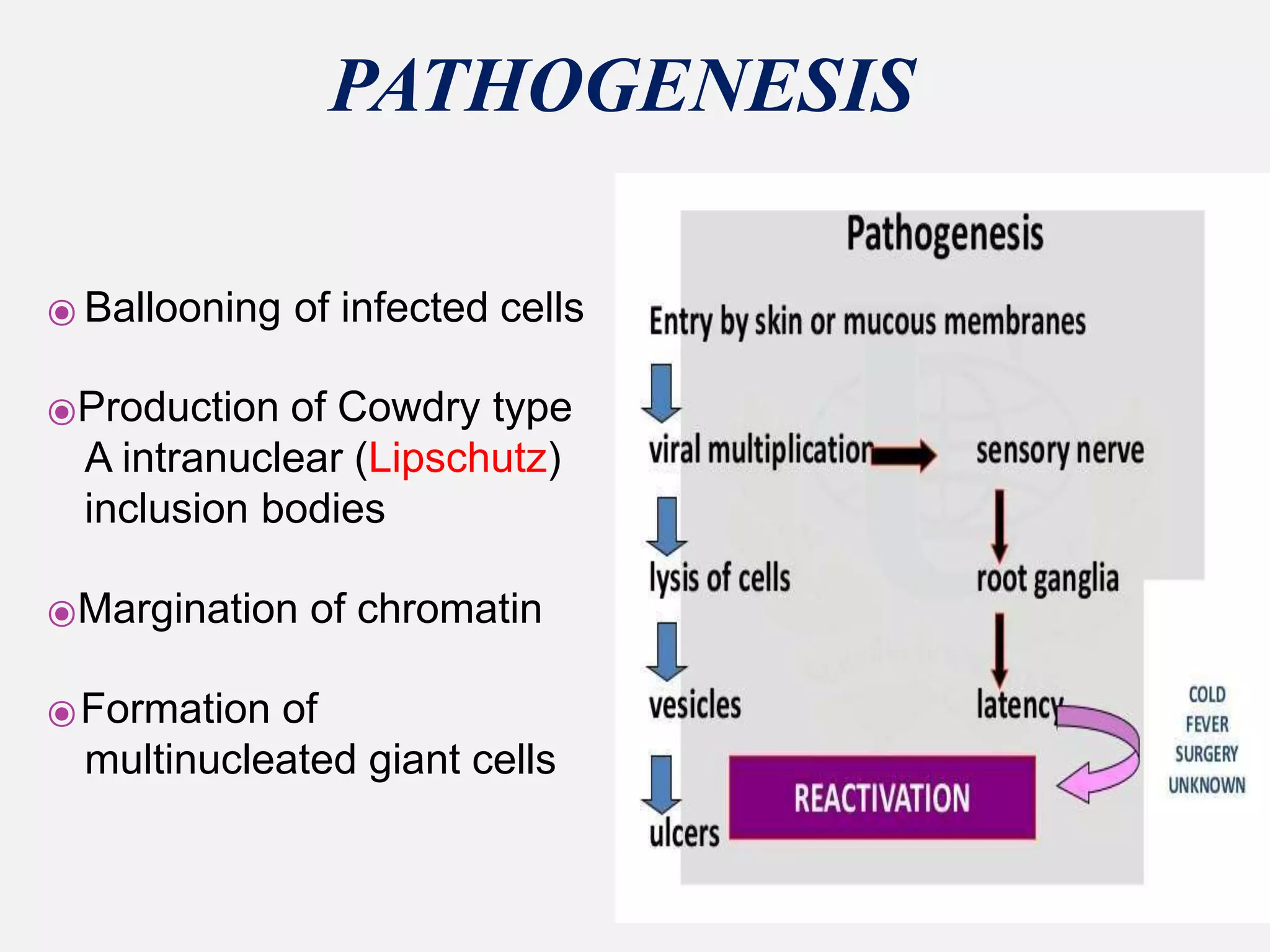 herpes simplex virus- ppt.pptx