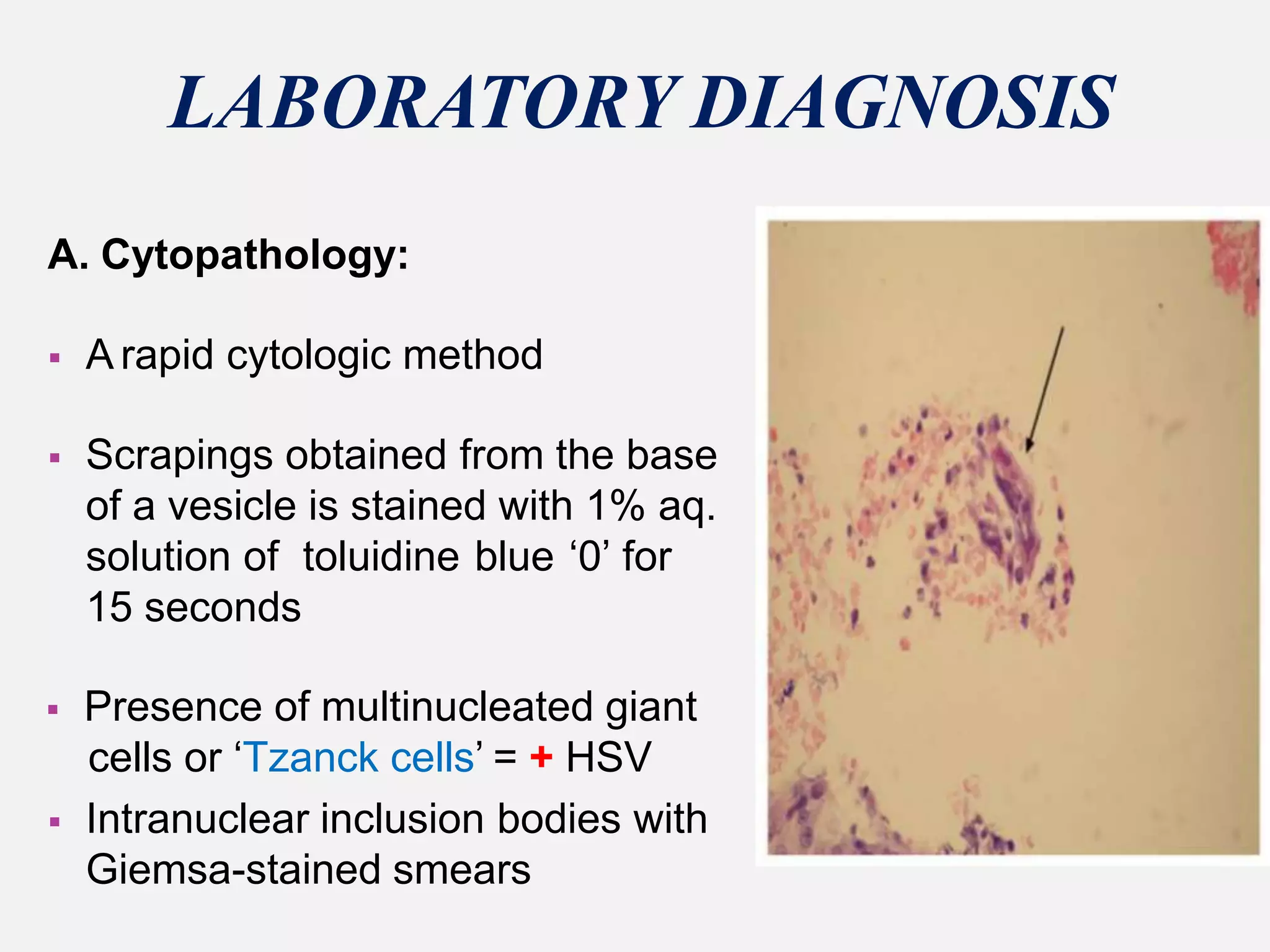 herpes simplex virus- ppt.pptx