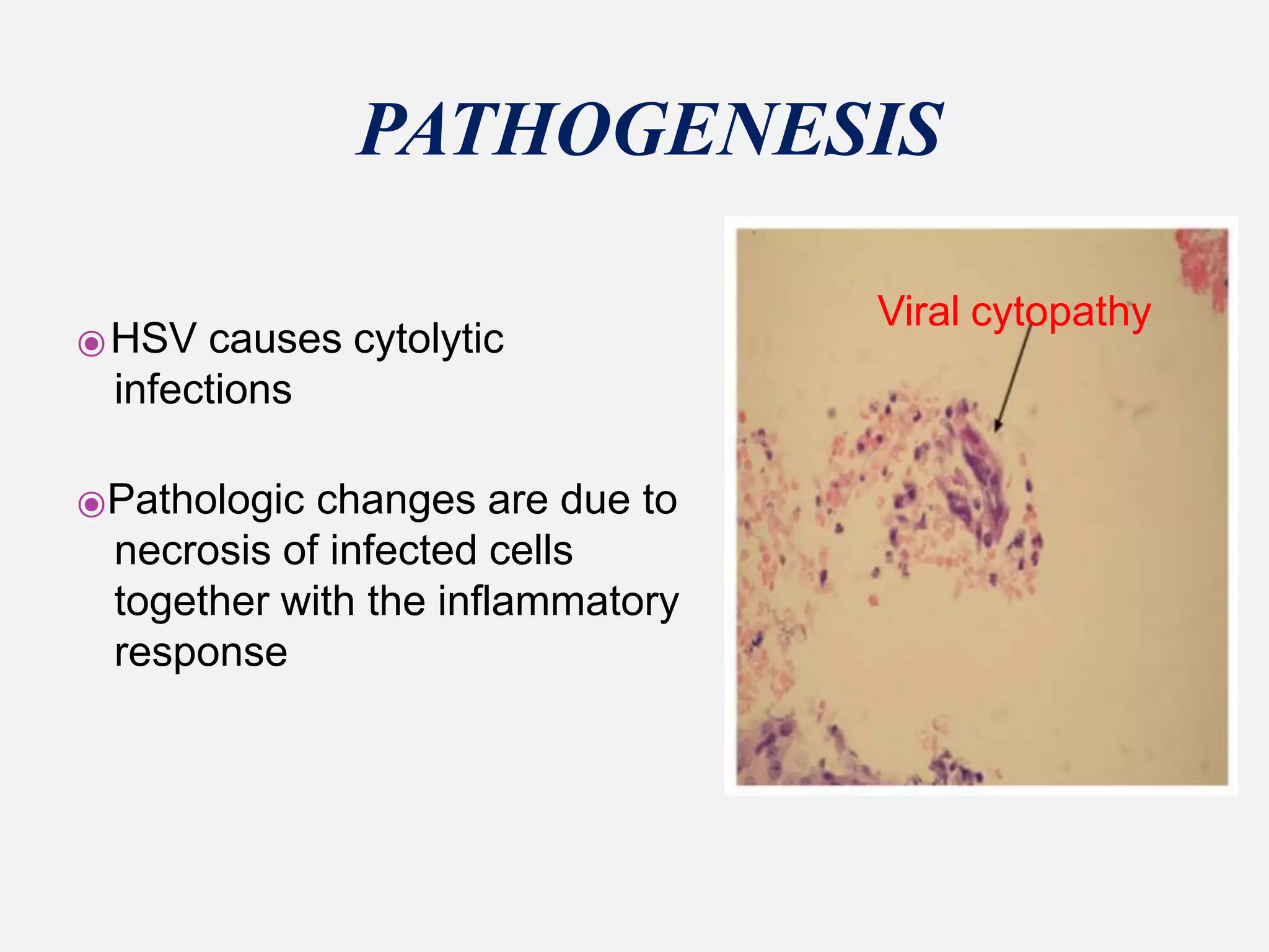 herpes simplex virus- ppt.pptx