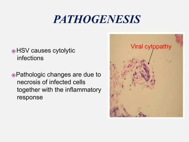 herpes simplex virus- ppt.pptx