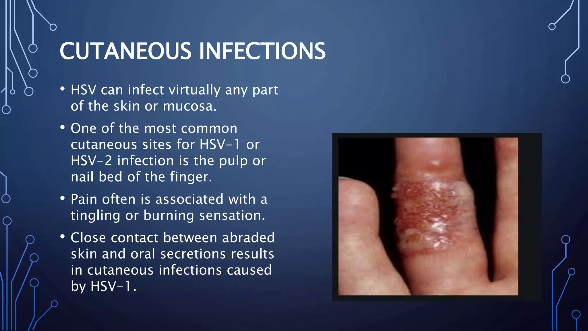 Herpes simplex virus Type 1 and Type 2 | PPTX