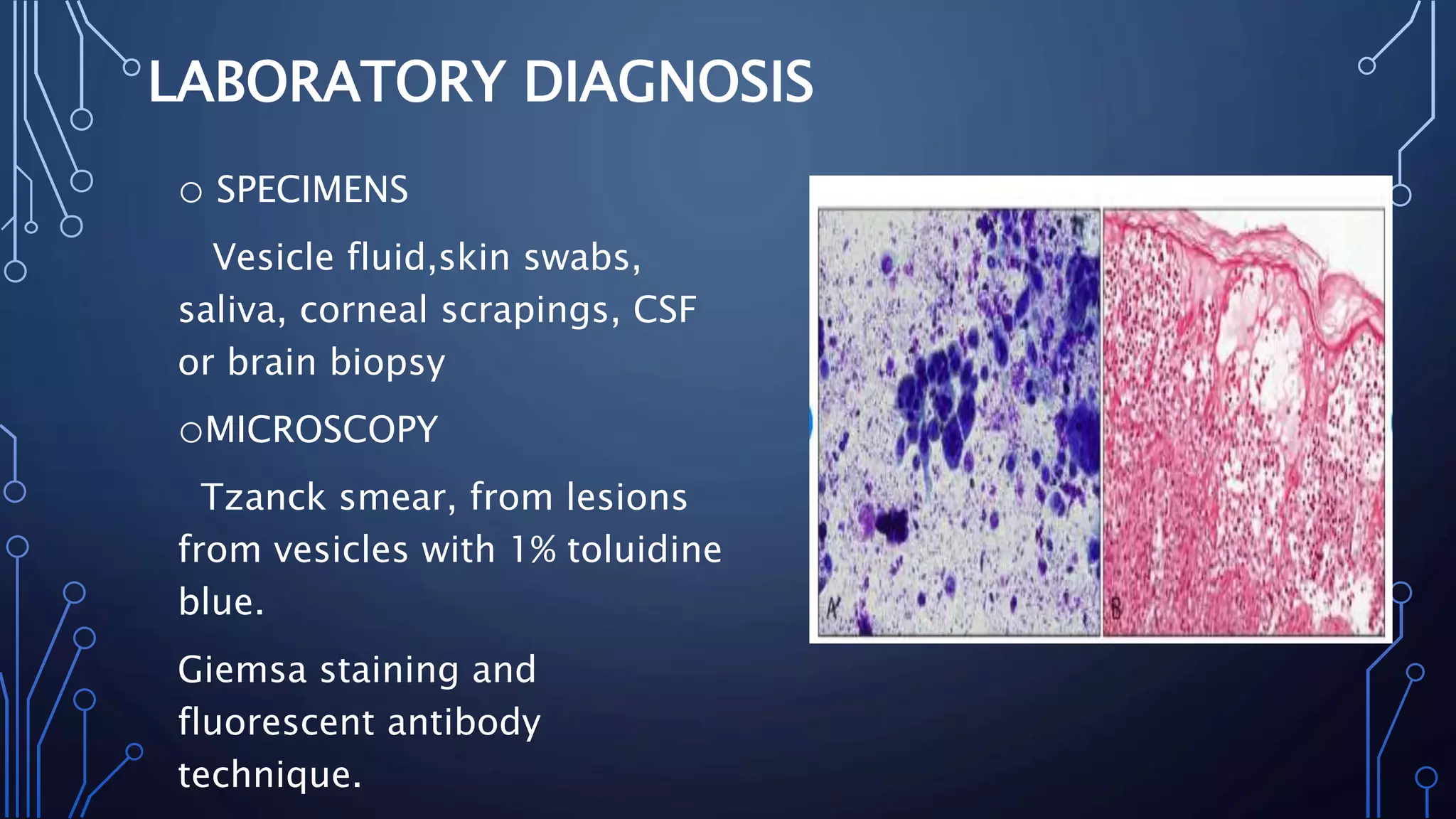 Herpes simplex virus Type 1 and Type 2 | PPTX