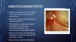 Herpes simplex virus Type 1 and Type 2 | PPTX