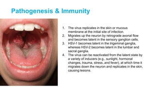 Herpes simplex virus 1 and 2 (HSV 1 and 2)) | PPTX