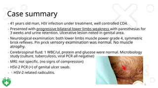 Herpes Simplex Virus radiculitis and treatment | PPTX