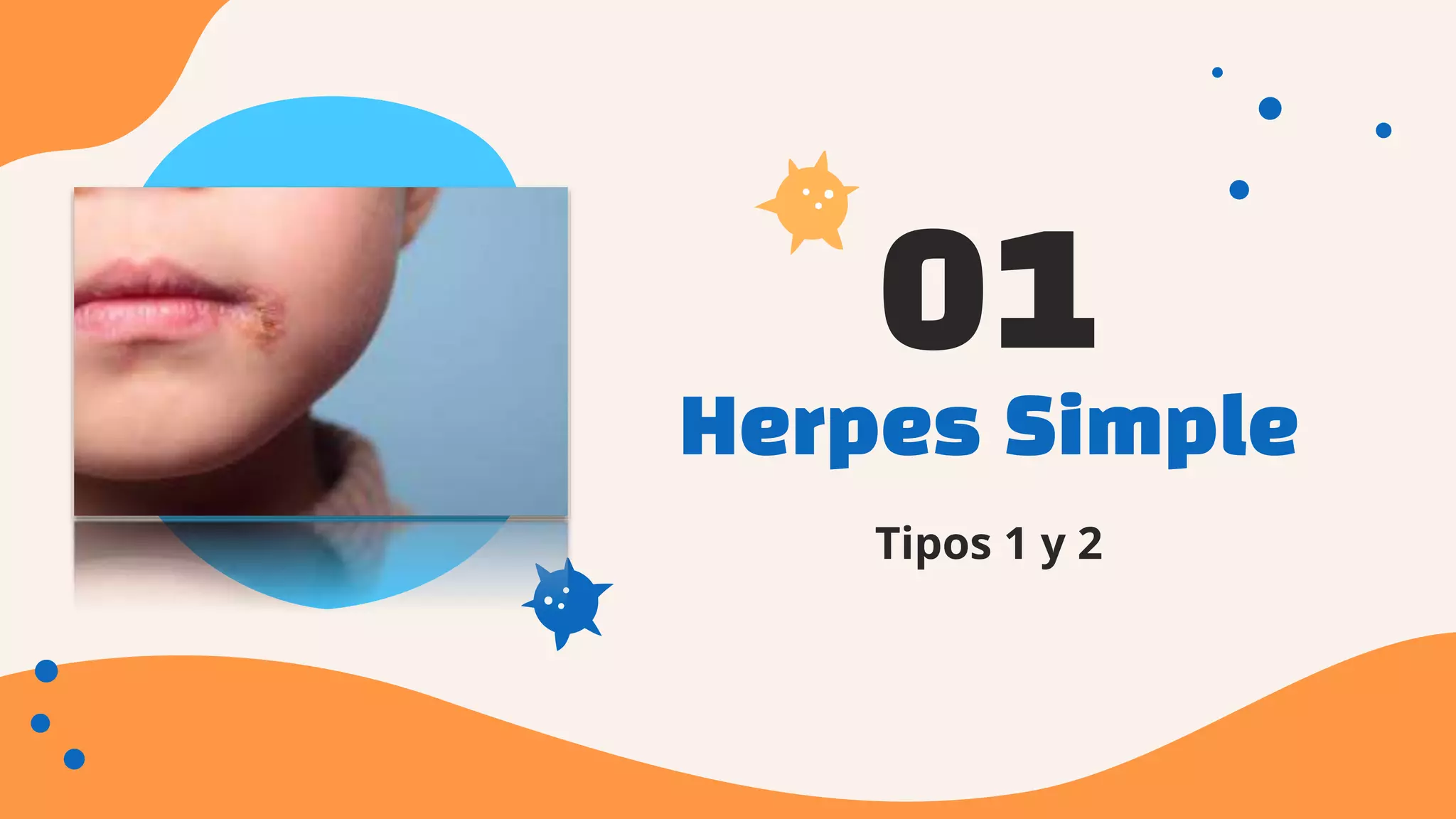 HERPES Simple y zoster.pptx