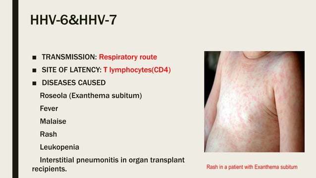 Herpesviridae with lab dx | PPT