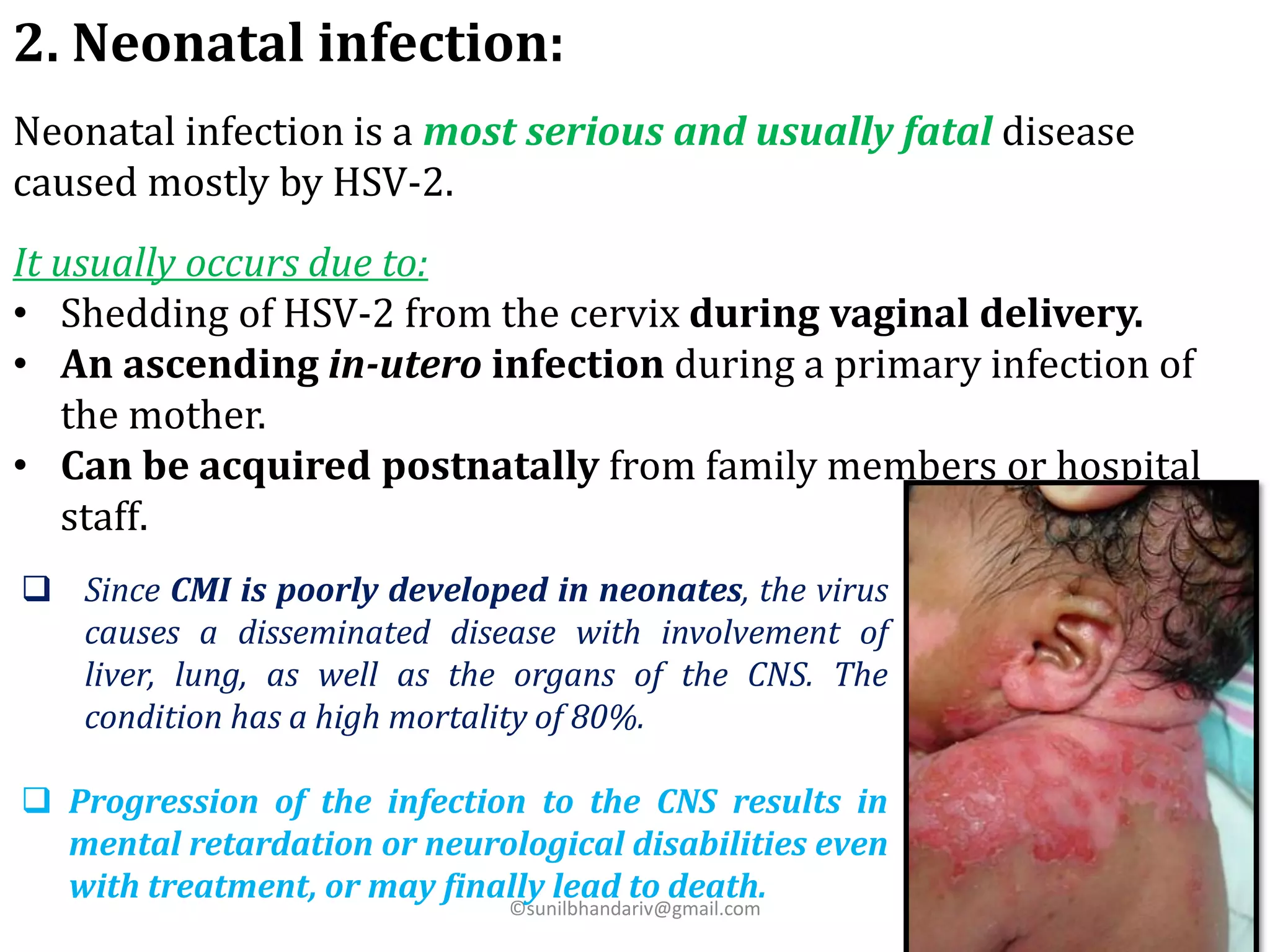 Herpesvirus | PDF