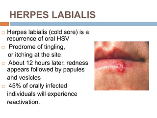 Herpes Virus.ppt