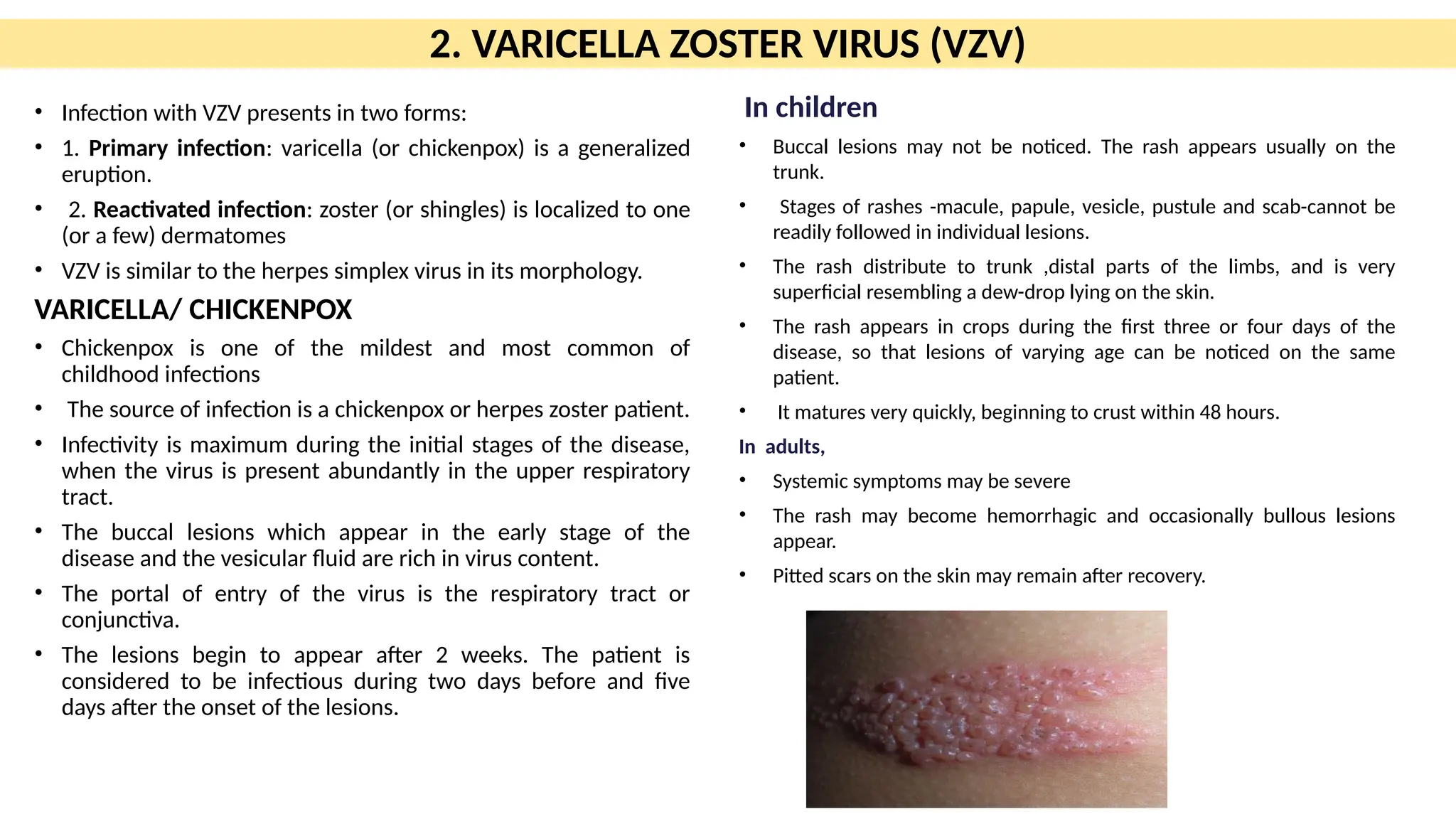HERPES VIRUS; FEATURES AND INFECTIONS.pptx