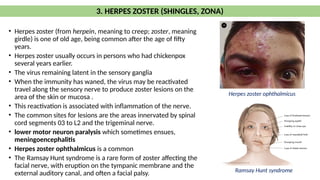 HERPES VIRUS; FEATURES AND INFECTIONS.pptx