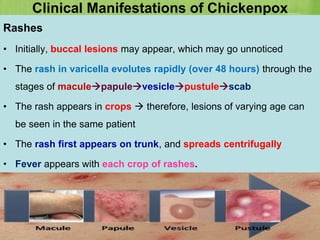 Herpes Virus and Varicella | PPT