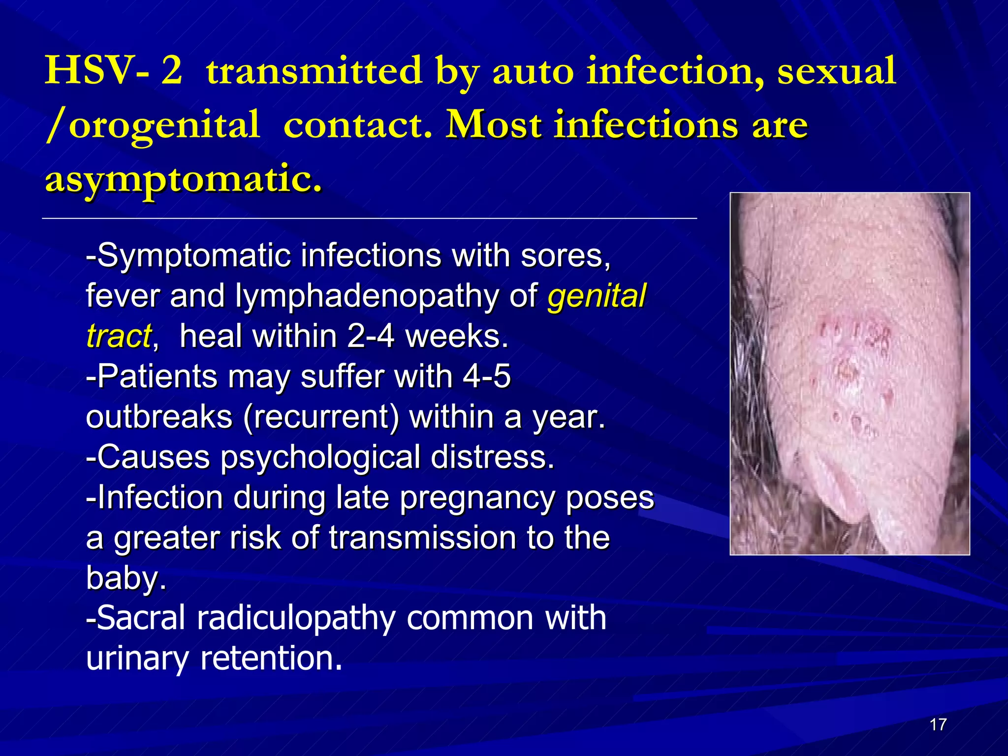 Herpes viruses | PPT