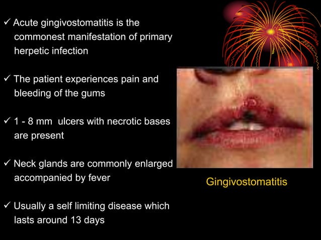 herpesviruses bacteria virus and infection | PPT