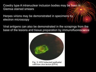herpesviruses bacteria virus and infection | PPT