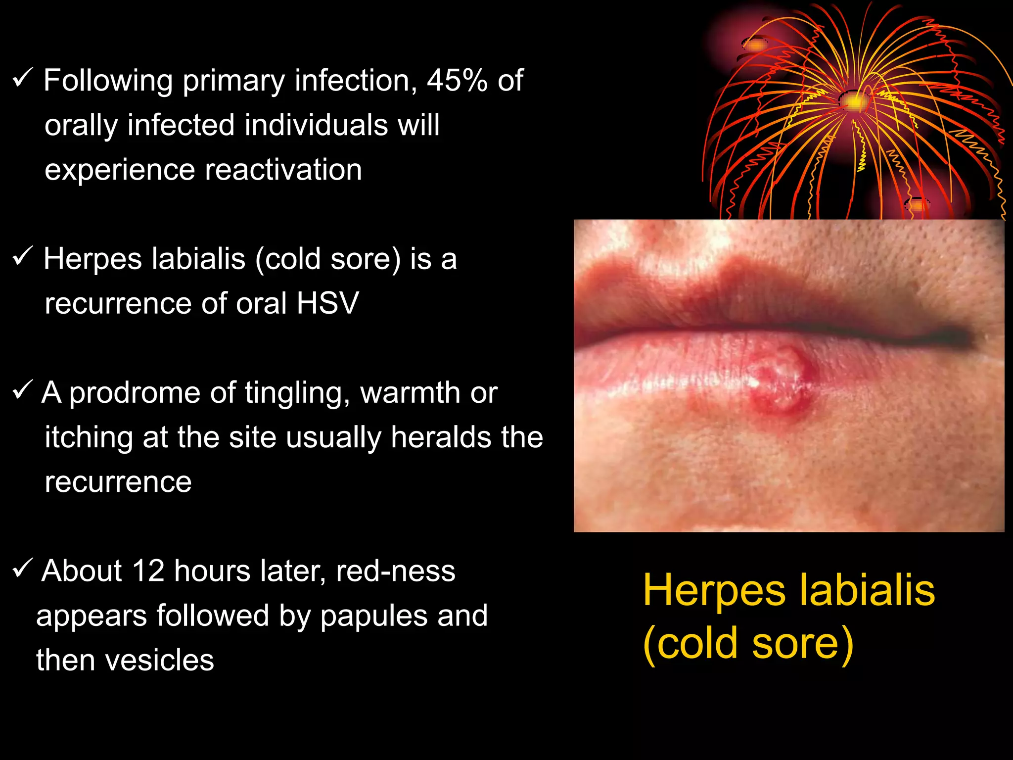Herpesviruses | PPT