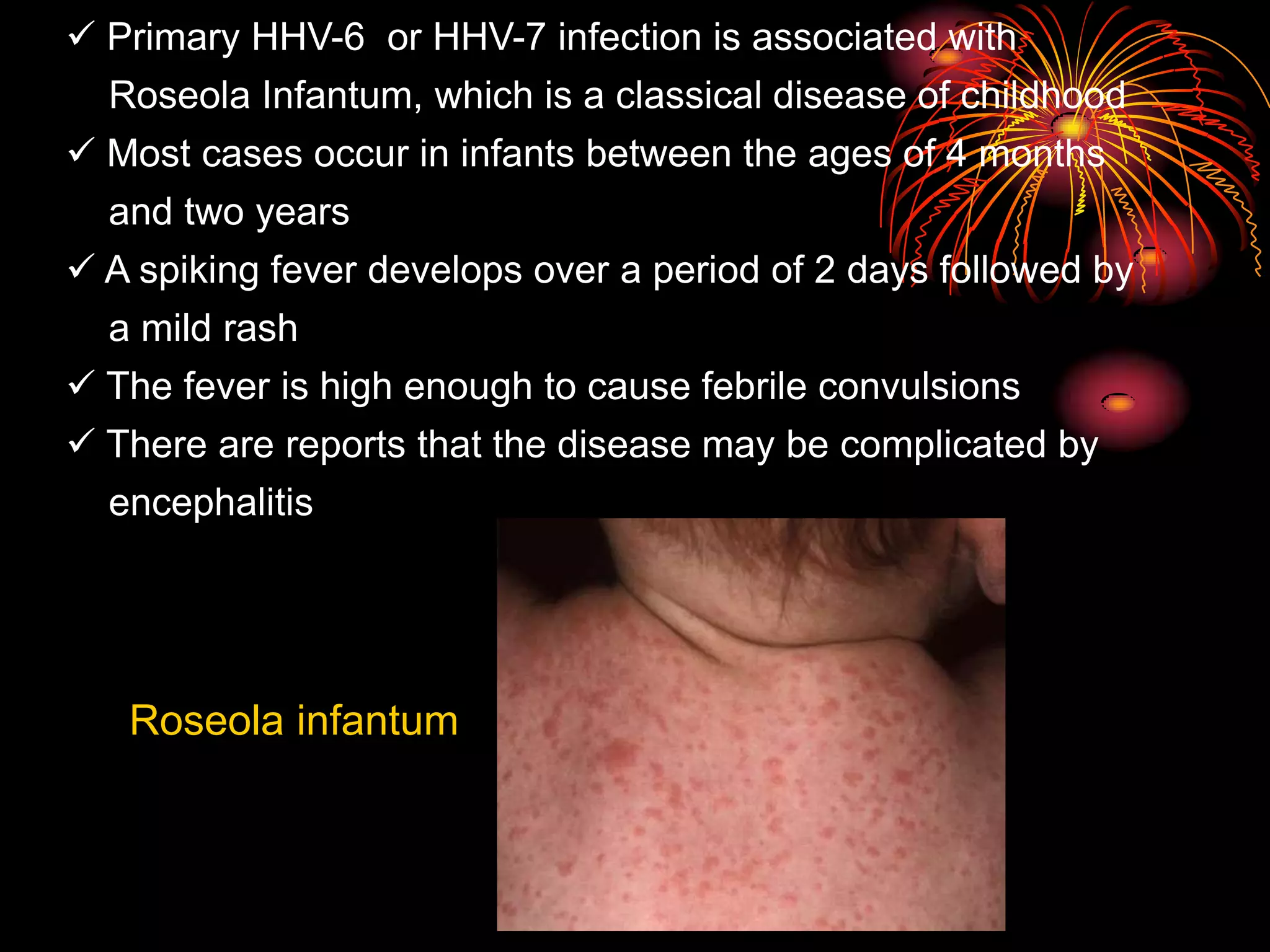 Herpesviruses | PPT