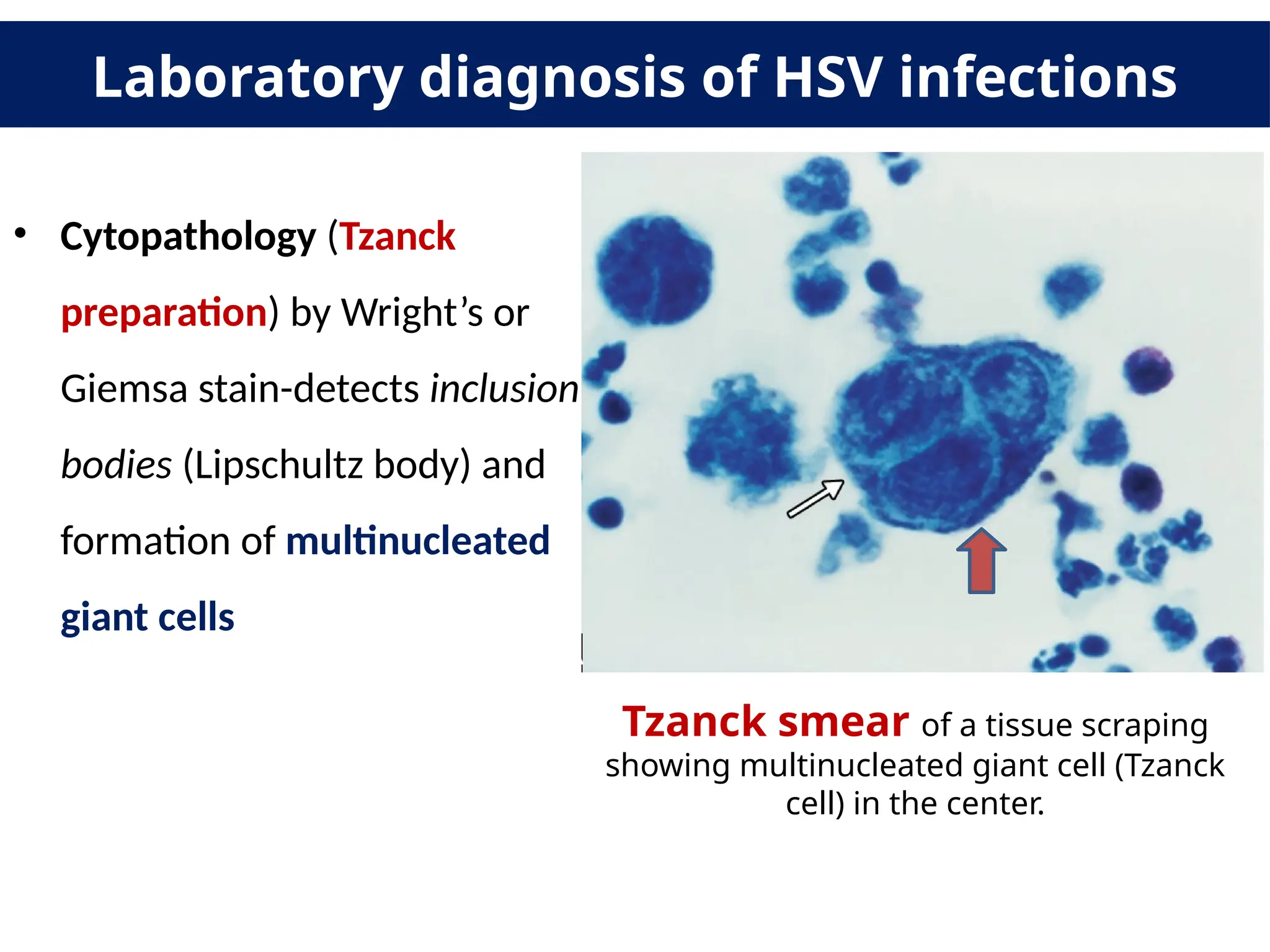 herpes viruses.pptx classification and discussion | PPTX