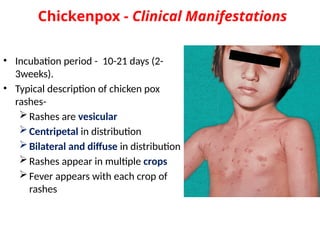 herpes viruses.pptx classification and discussion | PPTX