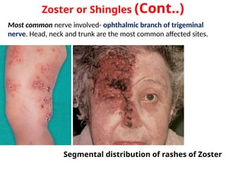 herpes viruses.pptx classification and discussion | PPTX