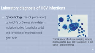 Herpes virus infection | PPTX
