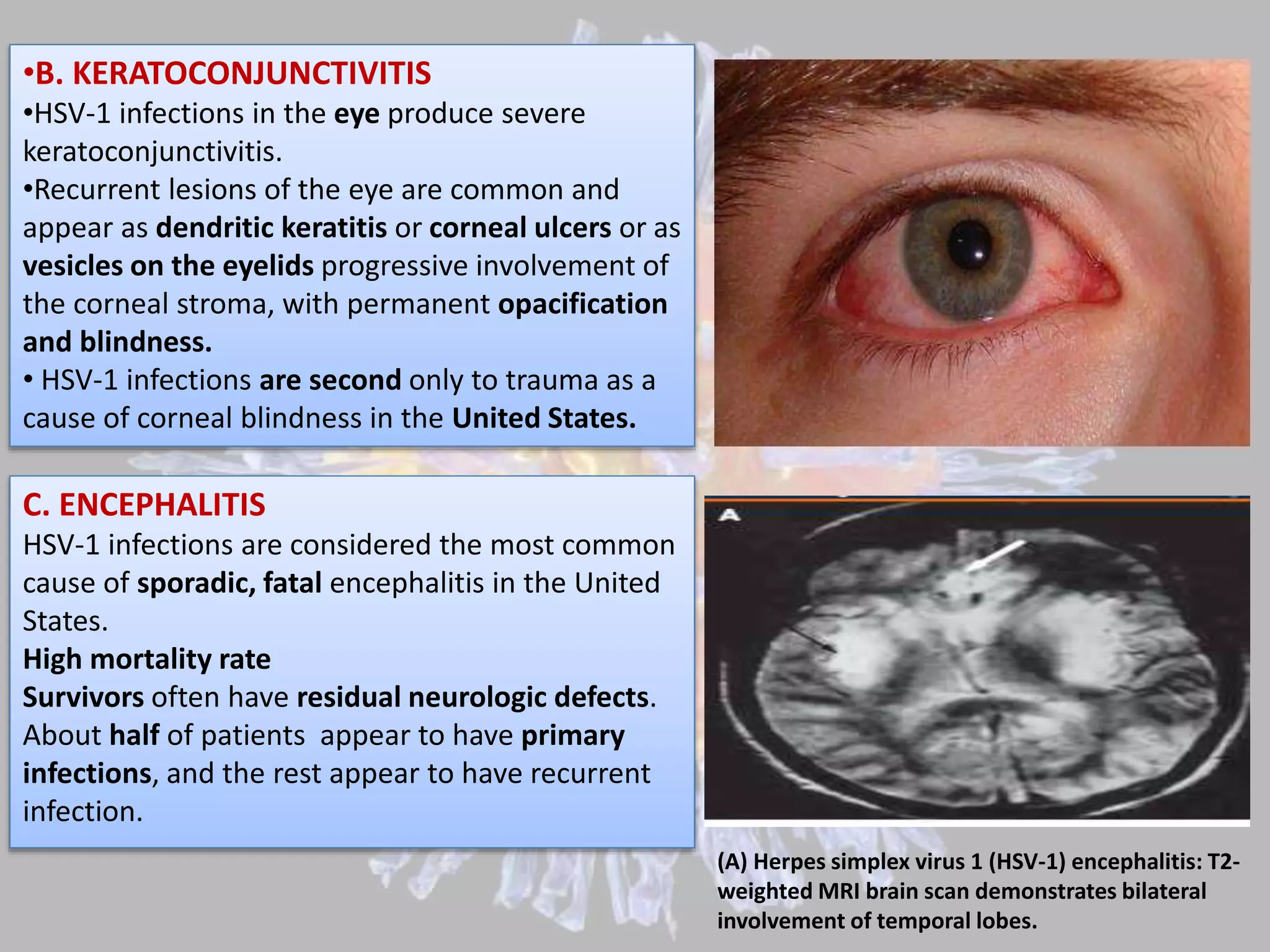 Herpes virus infections copy | PPTX