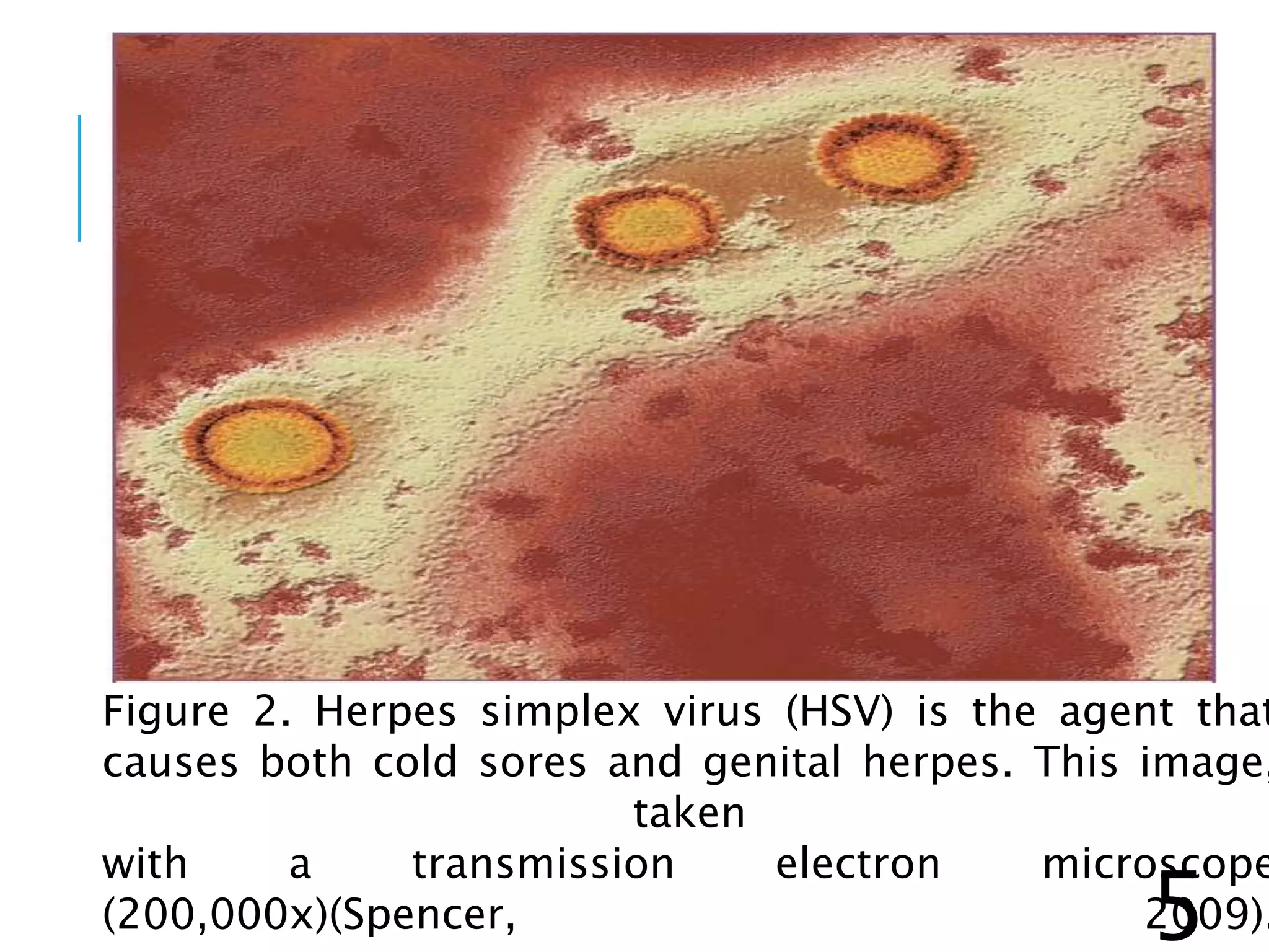 Biochemistry of herpes viruses | PPT