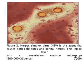 Biochemistry of herpes viruses | PPTX