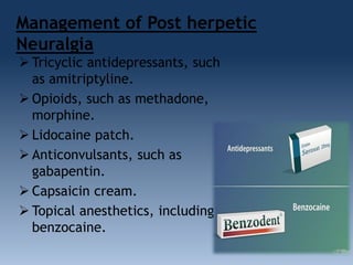 Herpes zoster | PPTX