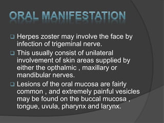 Herpes zoster | PPTX