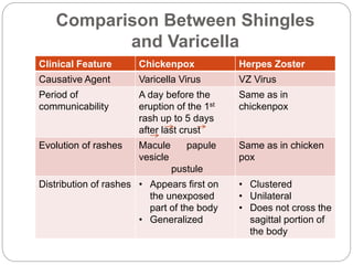 Herpes Zoster (Shigella) NCM 104 | PPTX