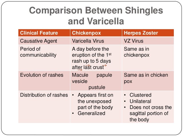 Herpes Zoster (Shigella) NCM 104