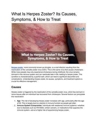 What Is Herpes Zoster? Its Causes, Symptoms, & How to Treat | PDF
