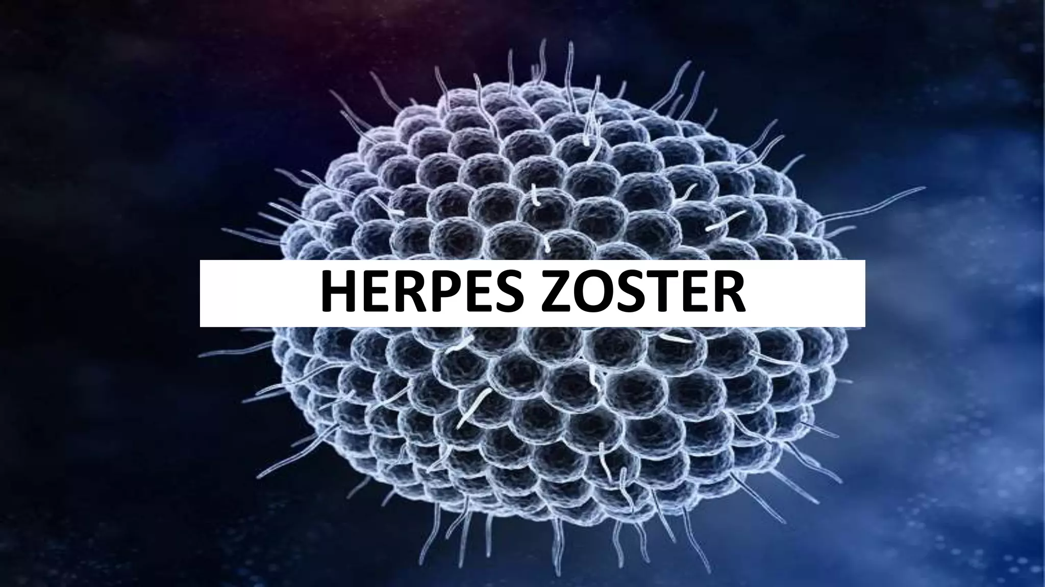 Herpes zoster shingles and chickenpox | PPTX