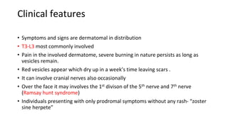 Herpes zoster shingles and chickenpox | PPTX