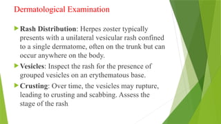 Herpes zoster 2.0.pptx healthcare . ayurveda for life | PPTX