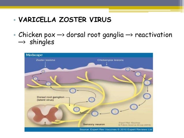 Herpes Zoster Ophthalmicus Pathogenesis
