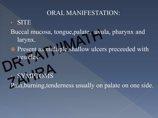 Herpes zoster ppt | PPTX